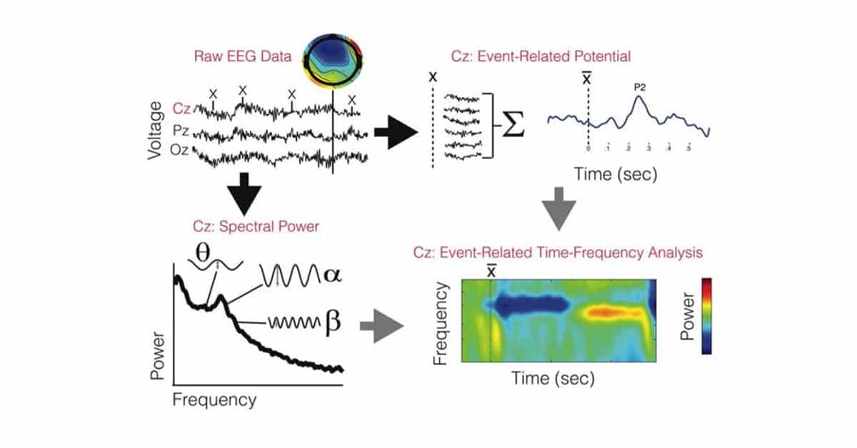 Use of EEG to diagnose ADHD - Extivita-RTP