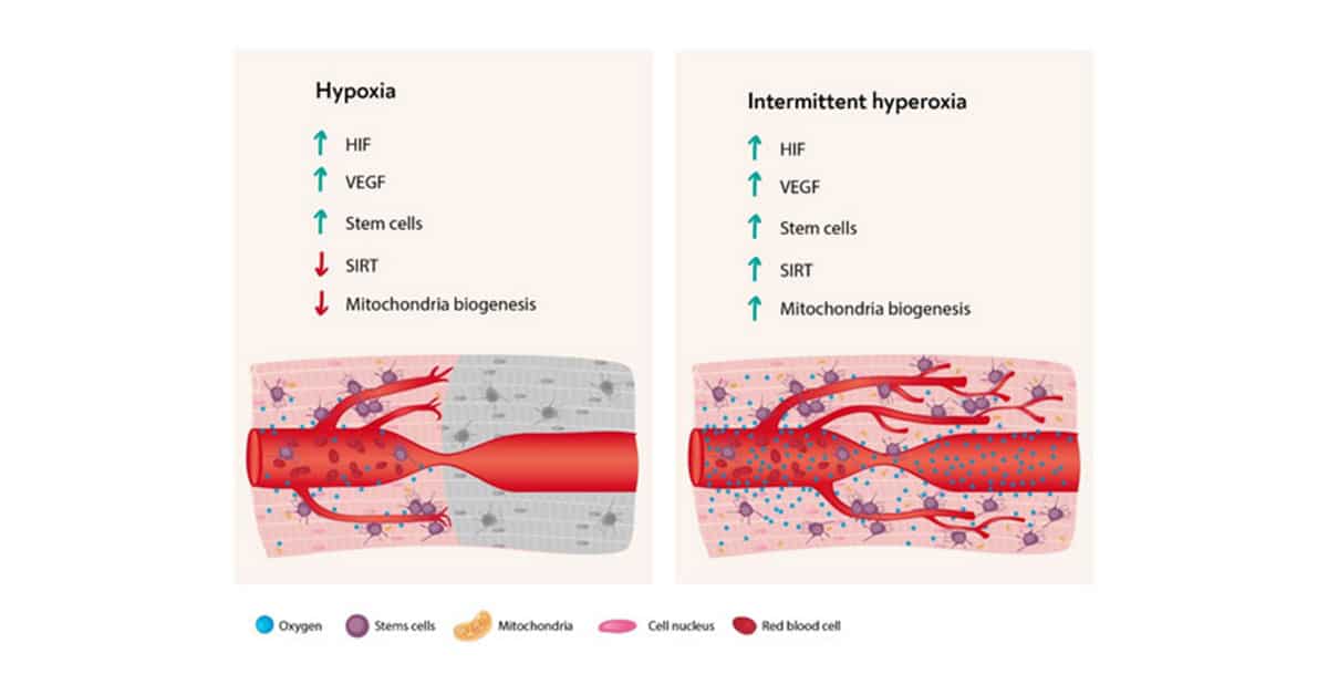 The Hyperoxic-Hypoxic Paradox - Extivita-RTP