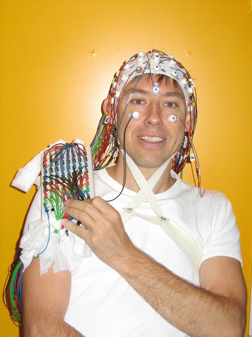 EEG Neurofeedback therapy: Can it attenuate brain changes in TBI ...