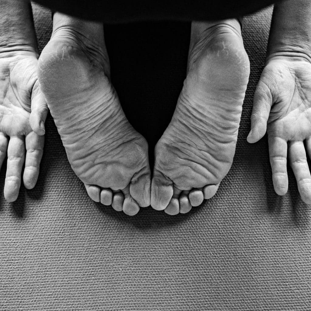 HBOT Restores Blood Flow To The Fingers And Toes In A COVID 19 Patient HBOT Restores Blood Flow To The Fingers And Toes In A COVID 19 Patient